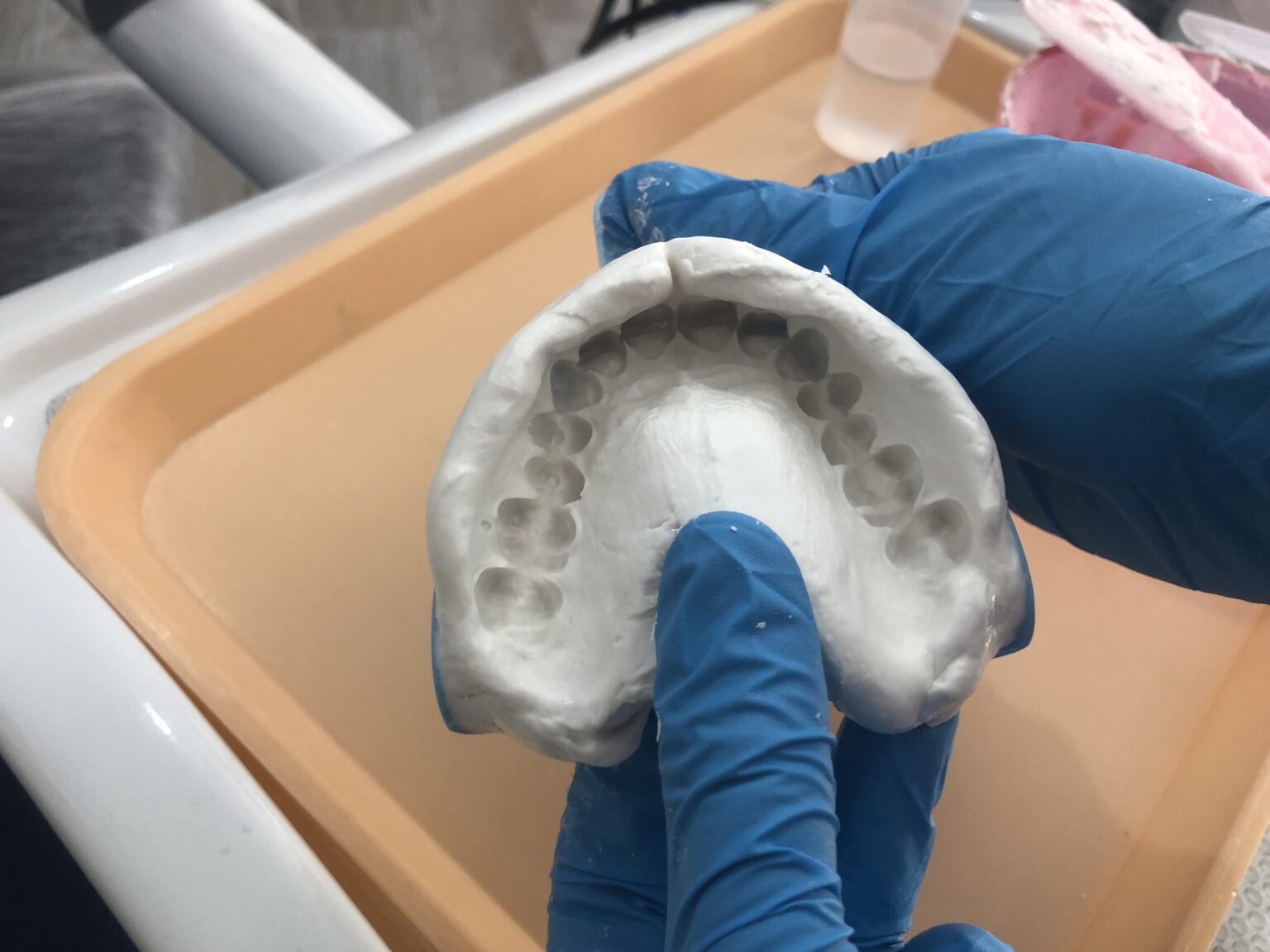 Elaboración de un guarda oclusal de acetato. – hr-dental.com